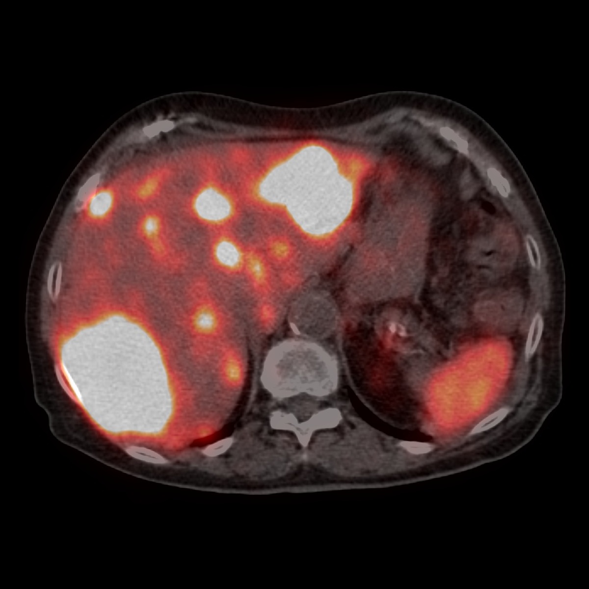 Online žiadanka – BIONT, a.s. – BRATISLAVSKÉ IÓNOVÉ TECHNOLÓGIE